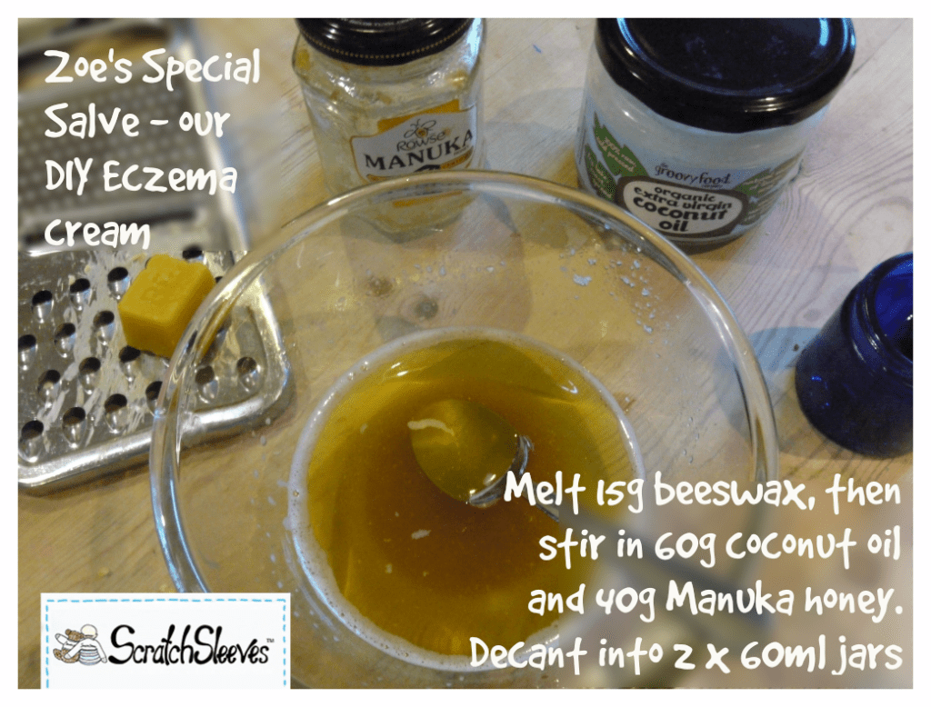 Zoë’s Special Salve - our favourite DIY eczema cream